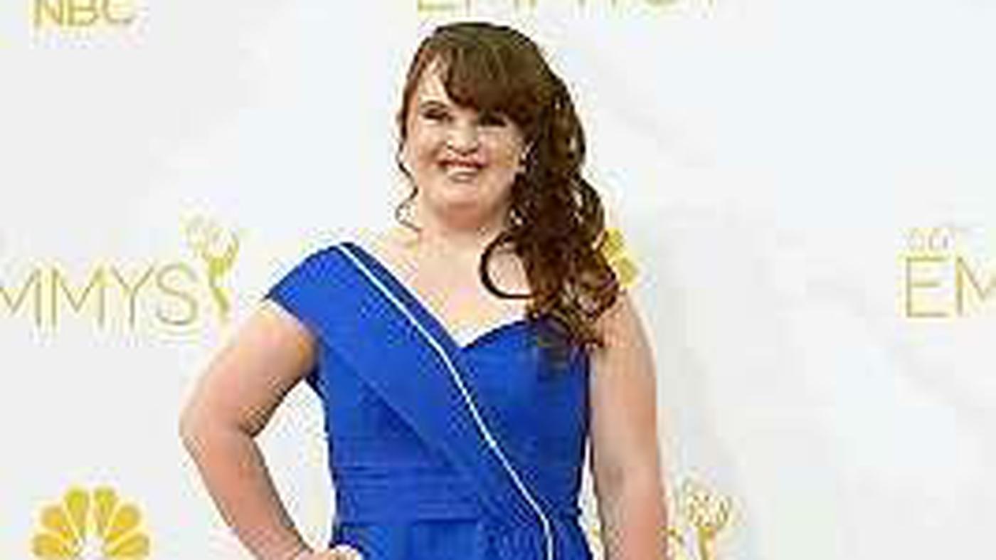US-Schauspielerin Jamie Brewer: Erstes Model mit Down-Syndrom auf der ...