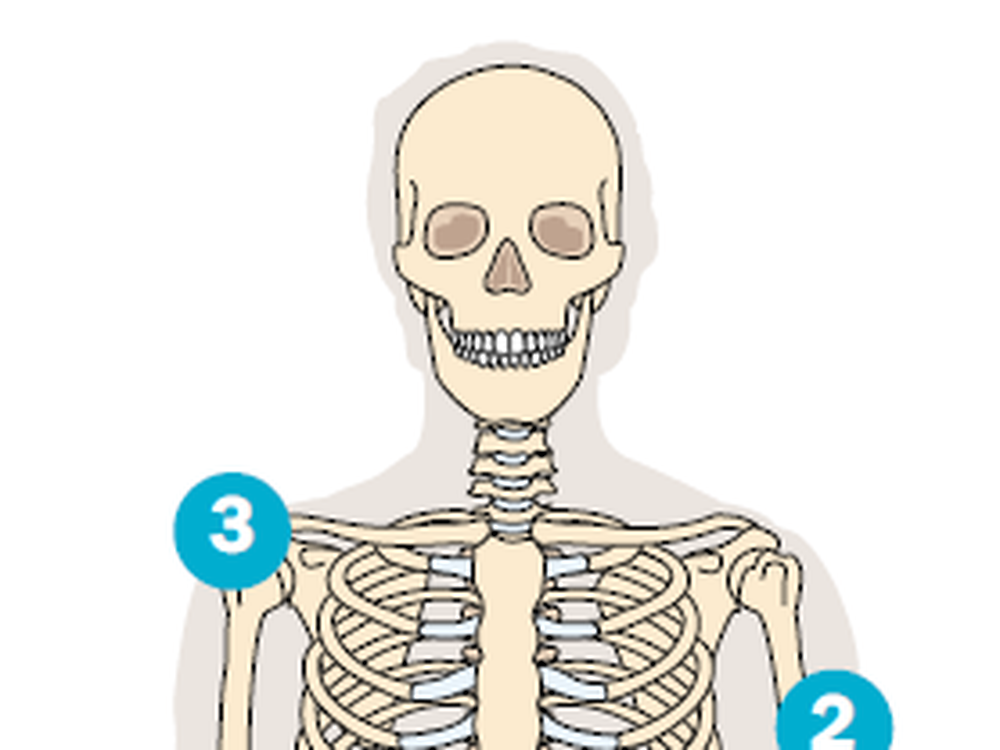 Was tun bei Knochenbrüchen?