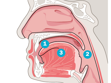 Mund- und Rachenkrebs erkennen und behandeln