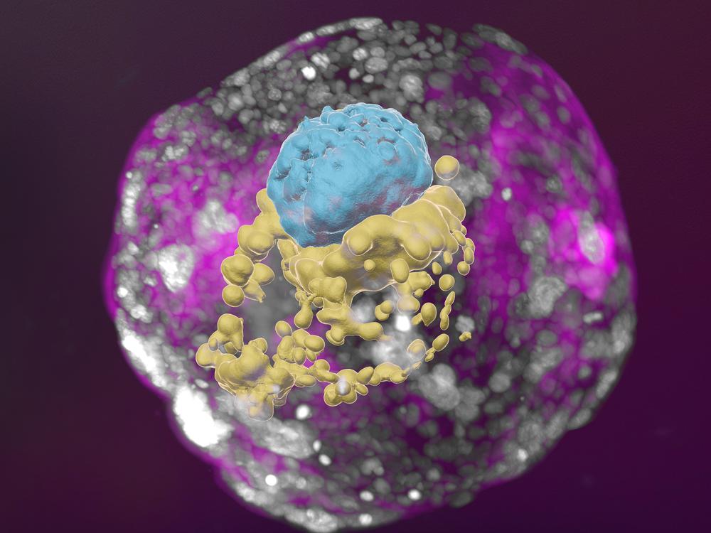 Stammzellenforscher Yaqub Hanna: „Dieses Wissen ist der Schlüssel, um ...