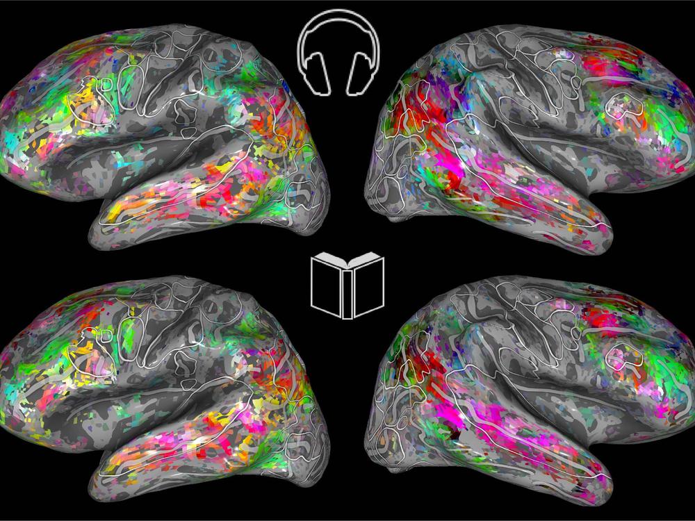 Hören oder Lesen?: Ein Blick ins Gehirn zeigt, wann mehr vom Text ...