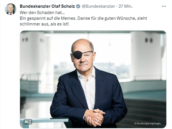 Nach Sturz in Potsdam: Olaf Scholz zeigt sich mit Augenklappe