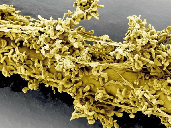 Krankheitserreger: Angriff der Pilze