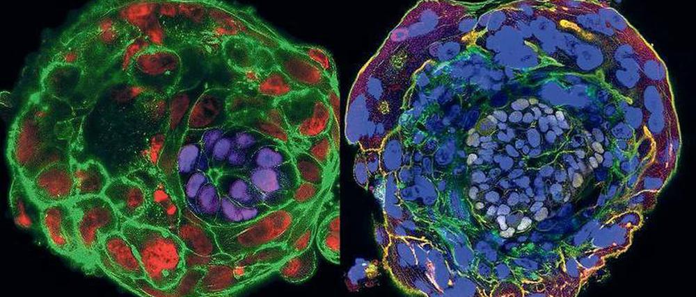 Menschliche Blastozyste